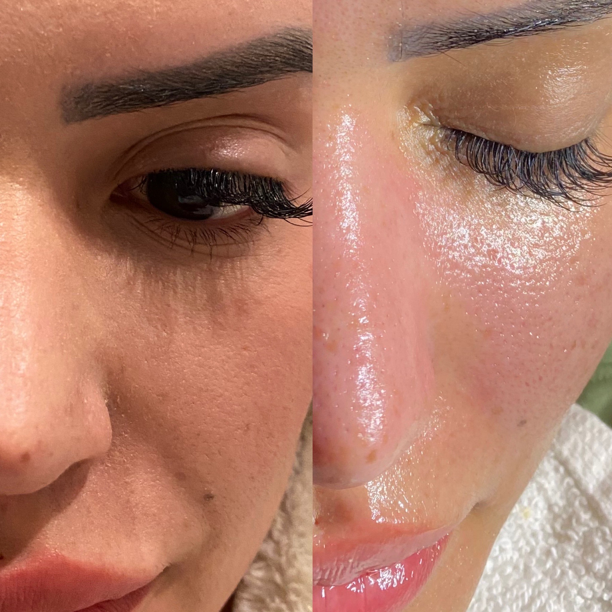 Billion-Dollar Facial Experience with Skin Expert Misha Tuleva